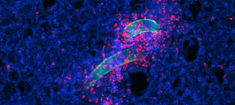 Hookworm therapy study expands to treat allergic inflammatory diseases