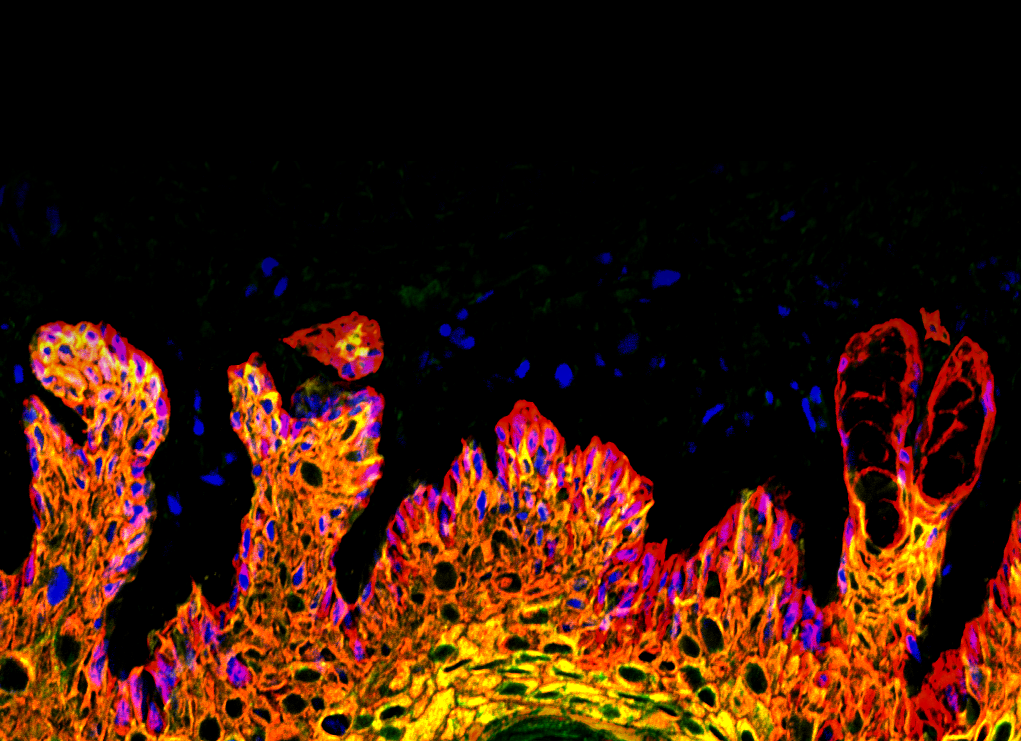 Allergic & inflammatory disease